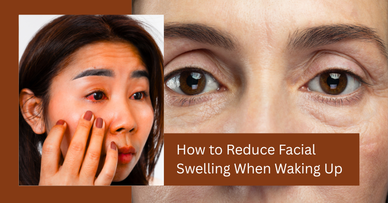 Facial Swelling When Waking Up: What Causes a Puffy Face?
