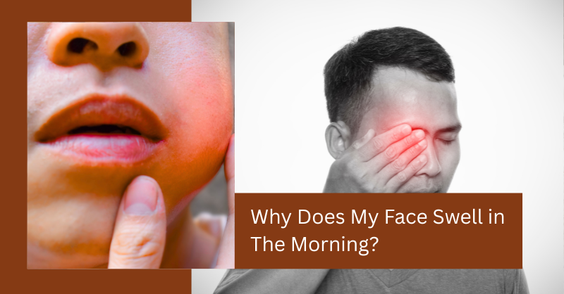 Facial Swelling When Waking Up: What Causes a Puffy Face?