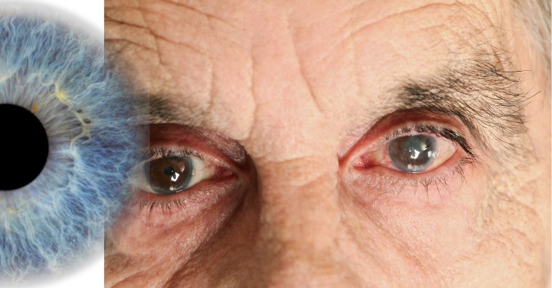 age-related eye problems Archives - Aaxcia Health